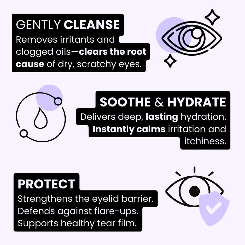 REALief™ Dry Eye Relief Eyelid Wipes—Wipe Away Eye Dryness! | EYEMOS®